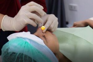 HIKO Nose Lift: How it feels like, where to get it, and everything you ...